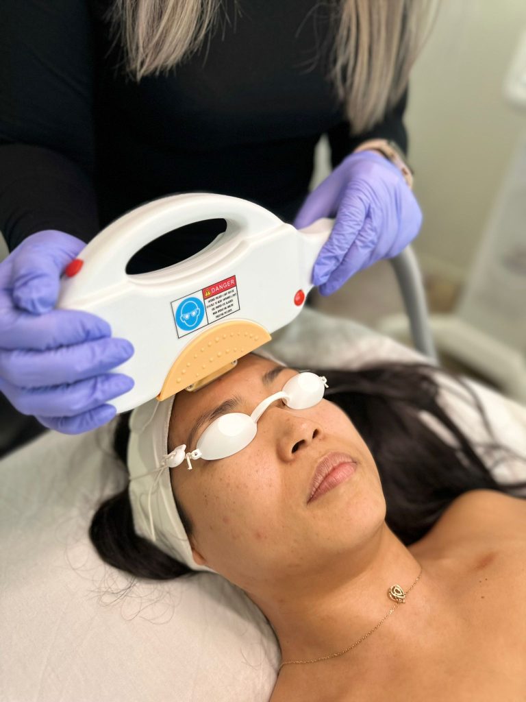 IPL Skin Rejuvenation – Envy Beauty Aesthetics